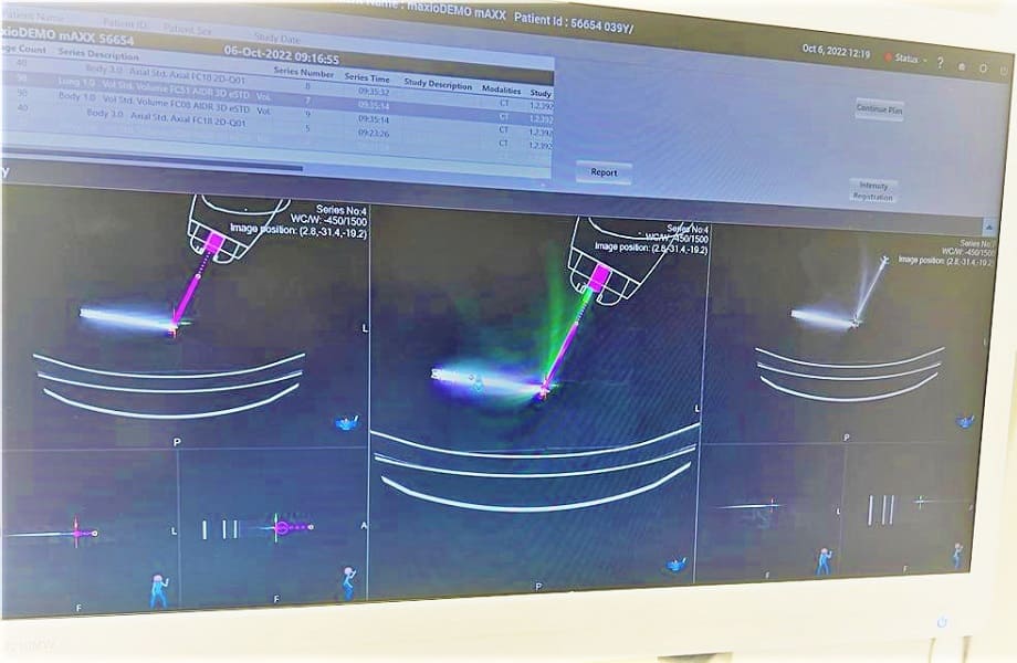 Инвазивные вмешательства перешли на новый уровень: биопсийный робот ...